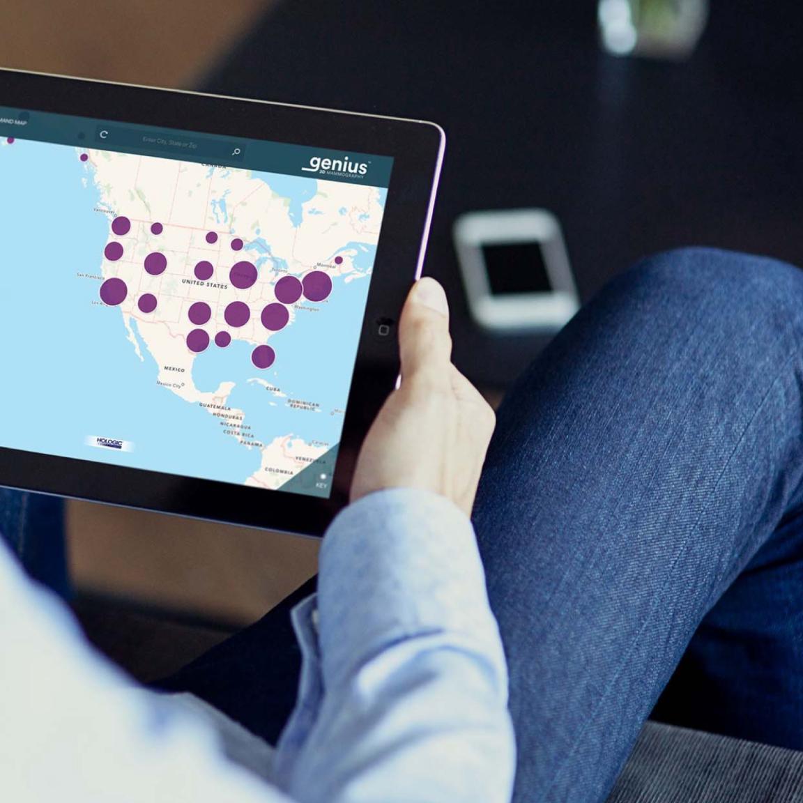 Hologic Genius 3D | Digital Pulp